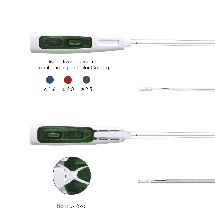 FastFit Anchor Razek – Adjustable - Razek | São Carlos